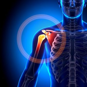 What can cause my shoulder pain? - Fountain Gate Physiotherapy